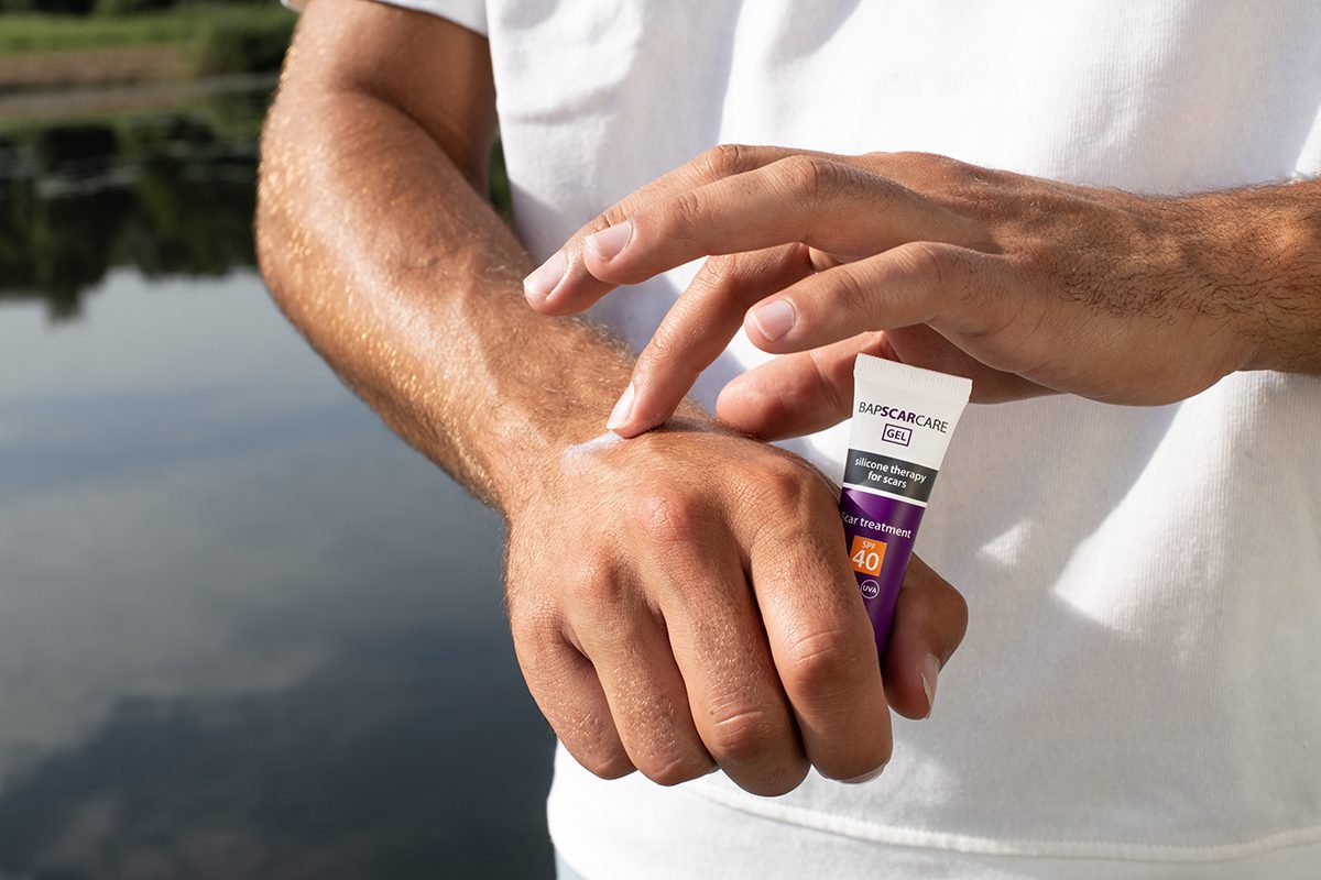 BAPSCARCARE littekenbehandeling met medische siliconen